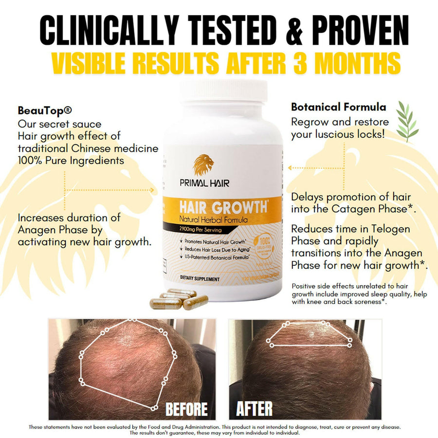 Primal Hair Growth Complex* – Primal Hair